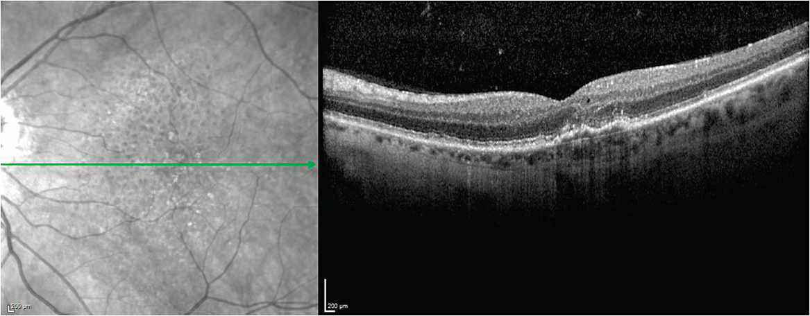 Ophthalmology Management | PentaVision