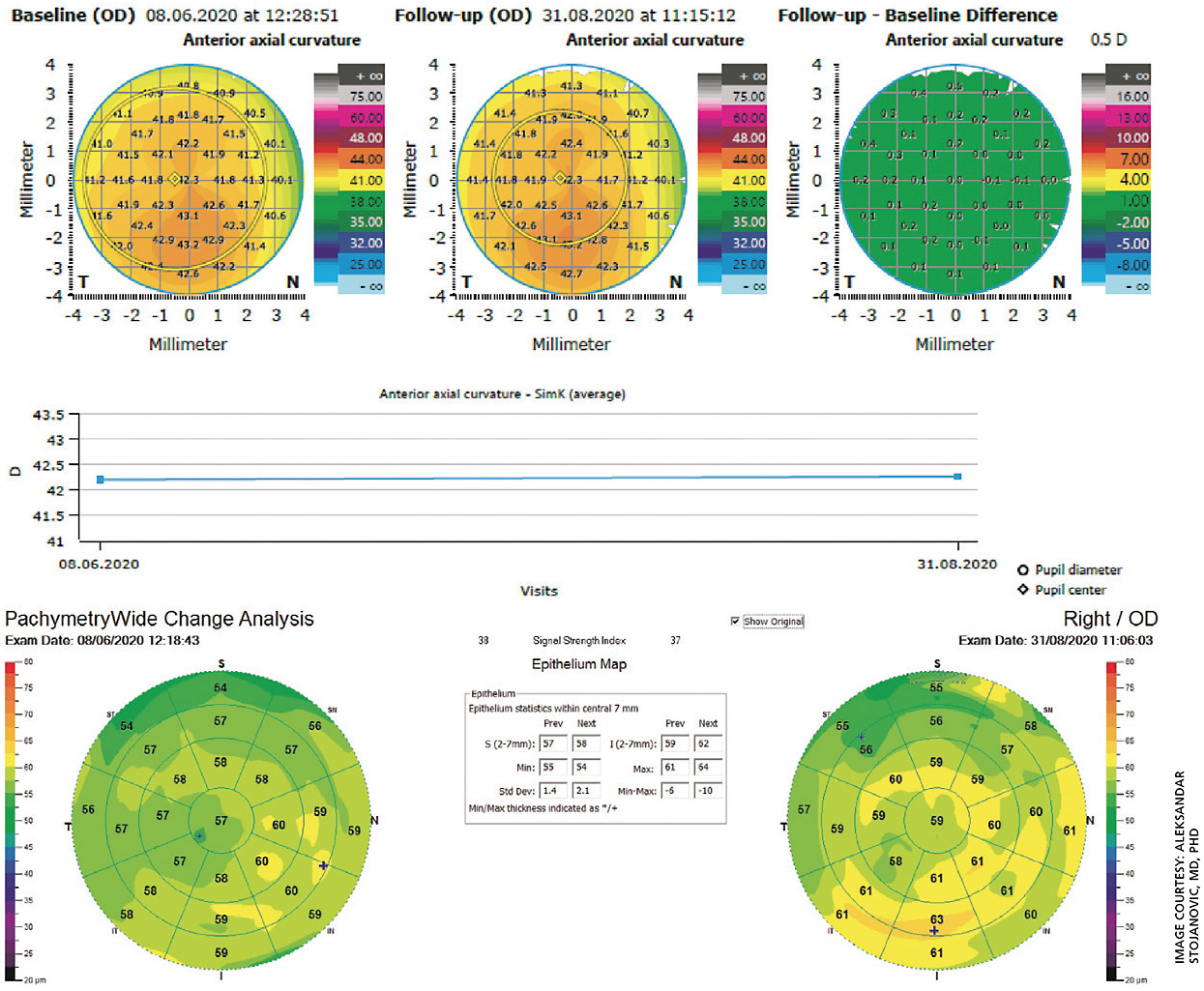 Ophthalmology Management | PentaVision