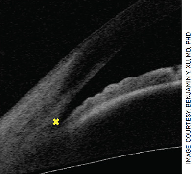 Ophthalmology Management | PentaVision