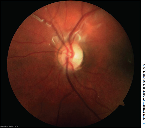 Ophthalmology Management | PentaVision